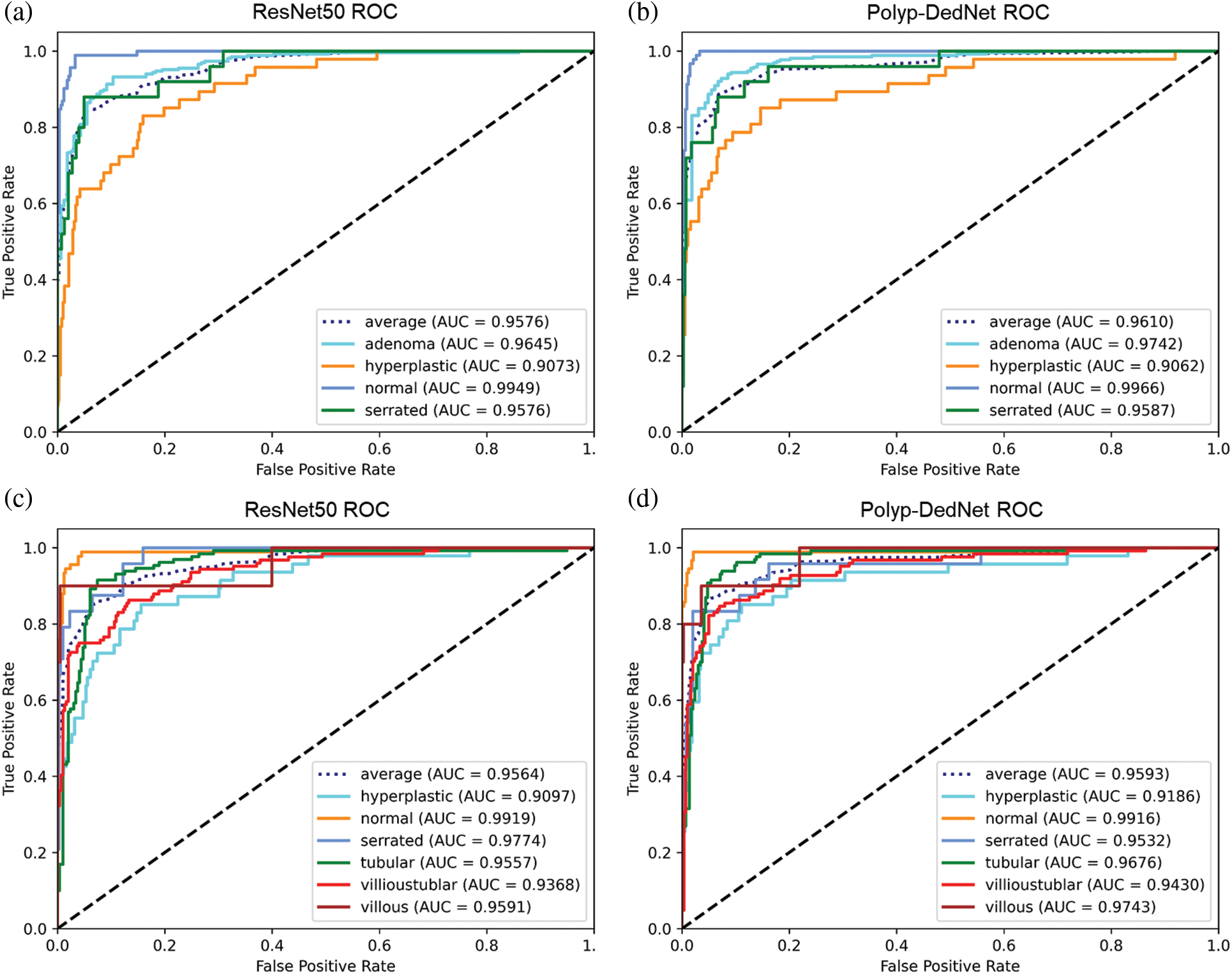 CMC | Free Full-Text | Multi-Classification of Polyps in Colonoscopy Images Based on an Improved ...
