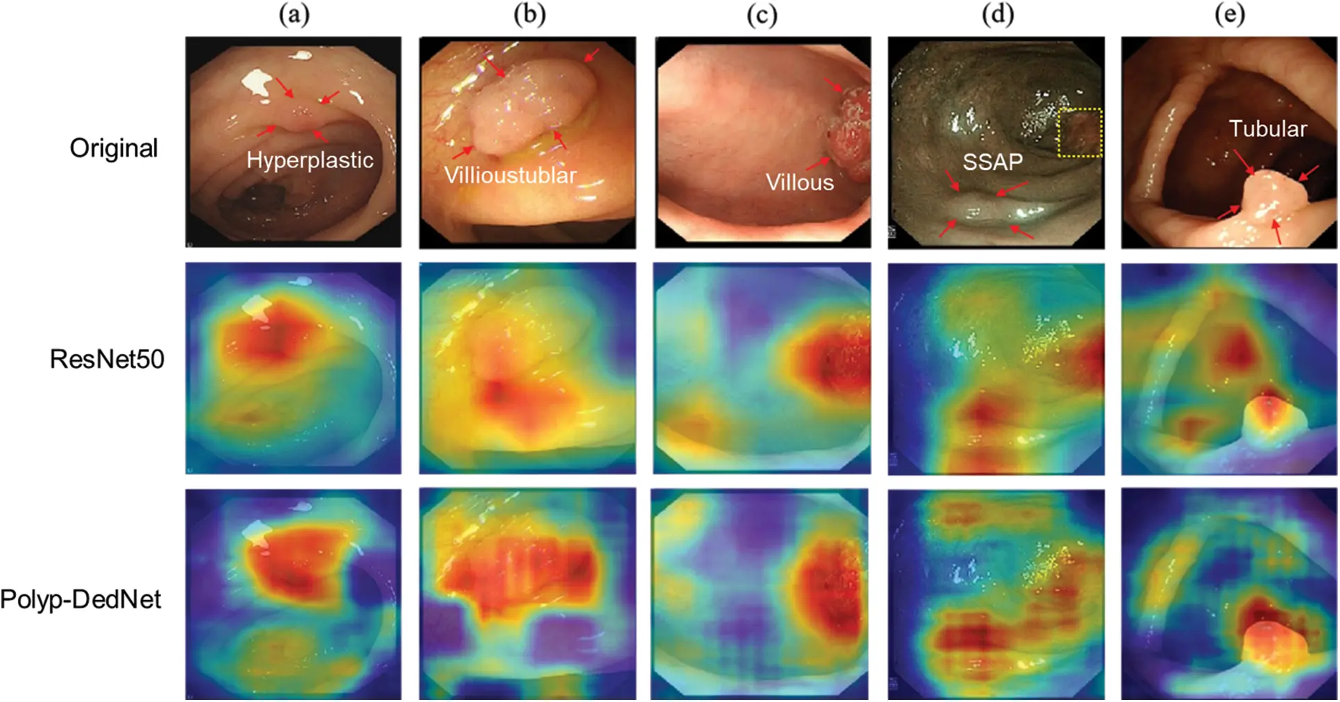 CMC | Free Full-Text | Multi-Classification of Polyps in Colonoscopy Images Based on an Improved ...