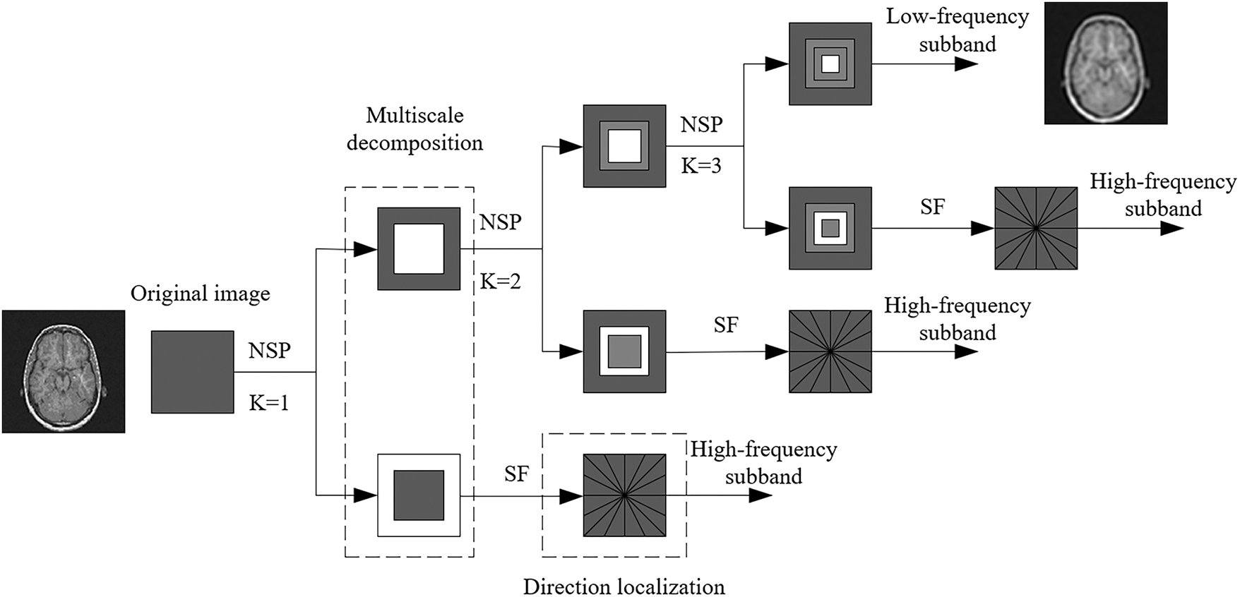 CMC | Free Full-Text | Robust Watermarking Algorithm for Medical Images ...