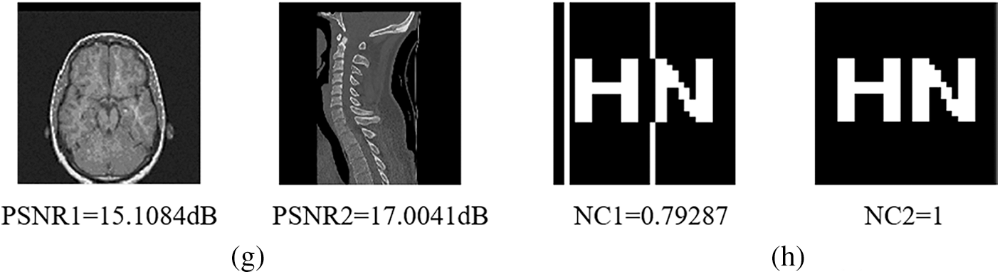 CMC | Free Full-Text | Robust Watermarking Algorithm for Medical Images ...