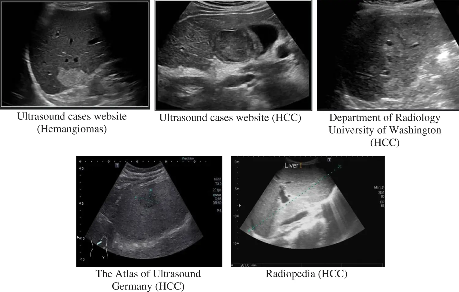 CMC | Free Full-Text | A Transfer Learning Approach Based on Ultrasound ...