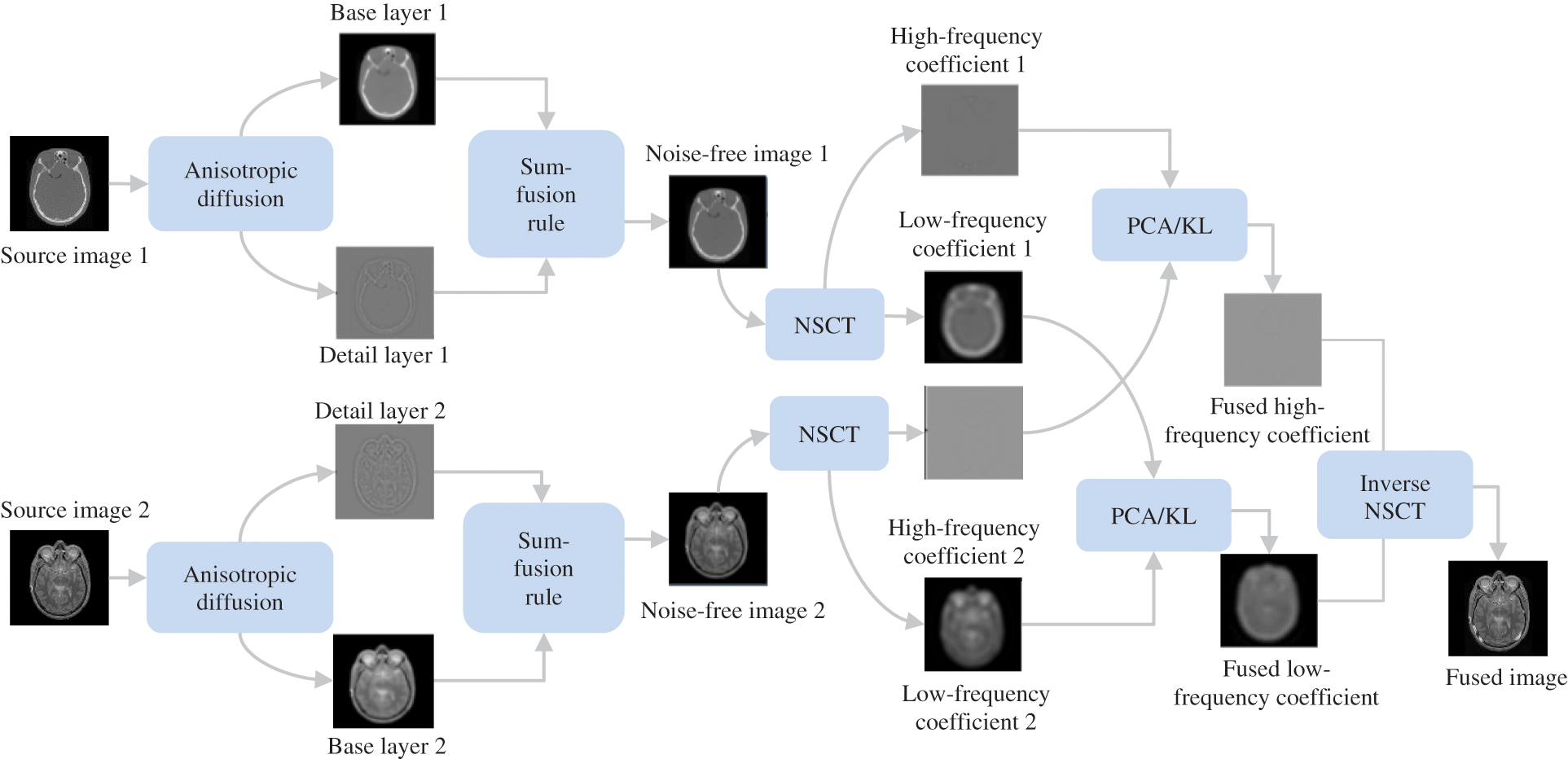 CMC | Free Full-Text | Medical Image Fusion Based on Anisotropic ...