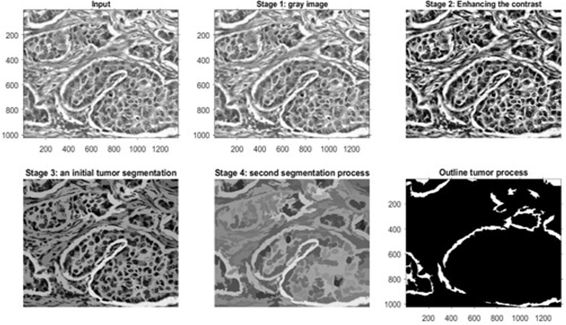 CMC | Free Full-Text | An Improved Fully Automated Breast Cancer ...