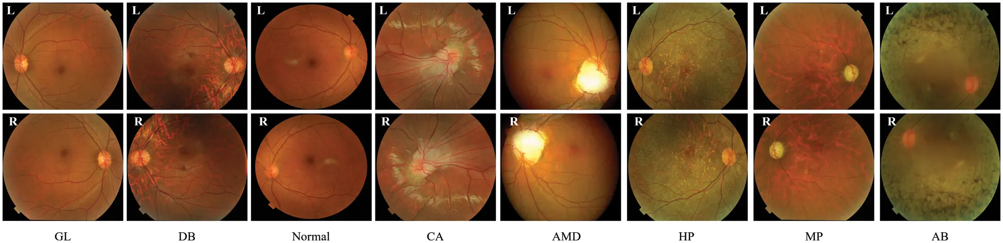 CMC | Free Full-Text | Spatial Correlation Module for Classification of ...