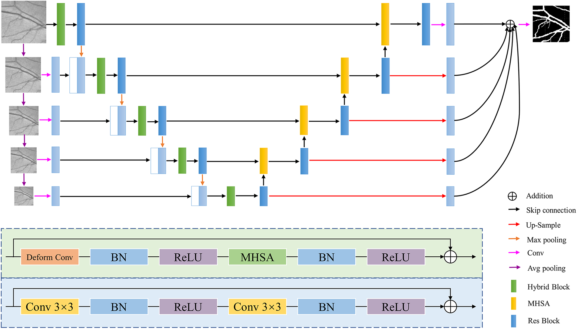 CMC | Free Full-Text | DT-Net: Joint Dual-Input Transformer and CNN for ...