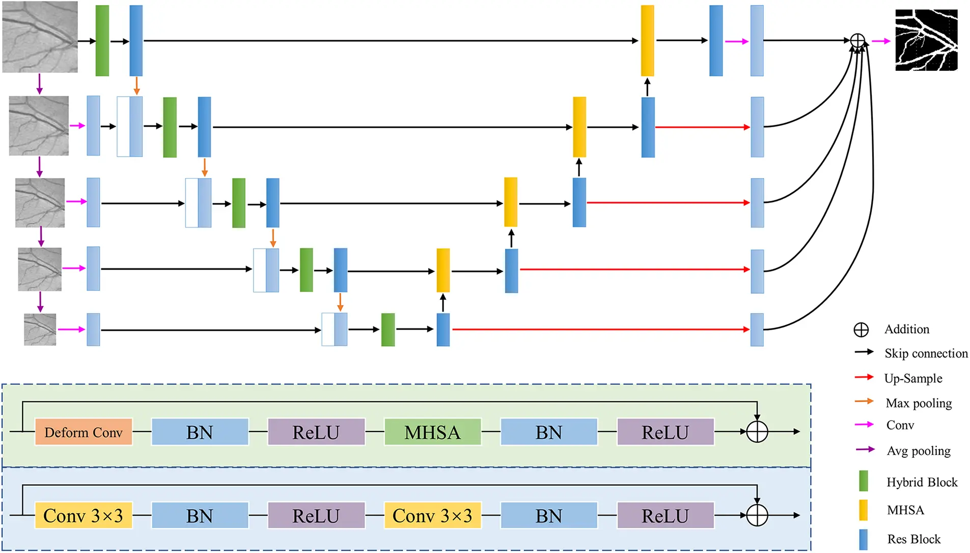 CMC | Free Full-Text | DT-Net: Joint Dual-Input Transformer and CNN for ...