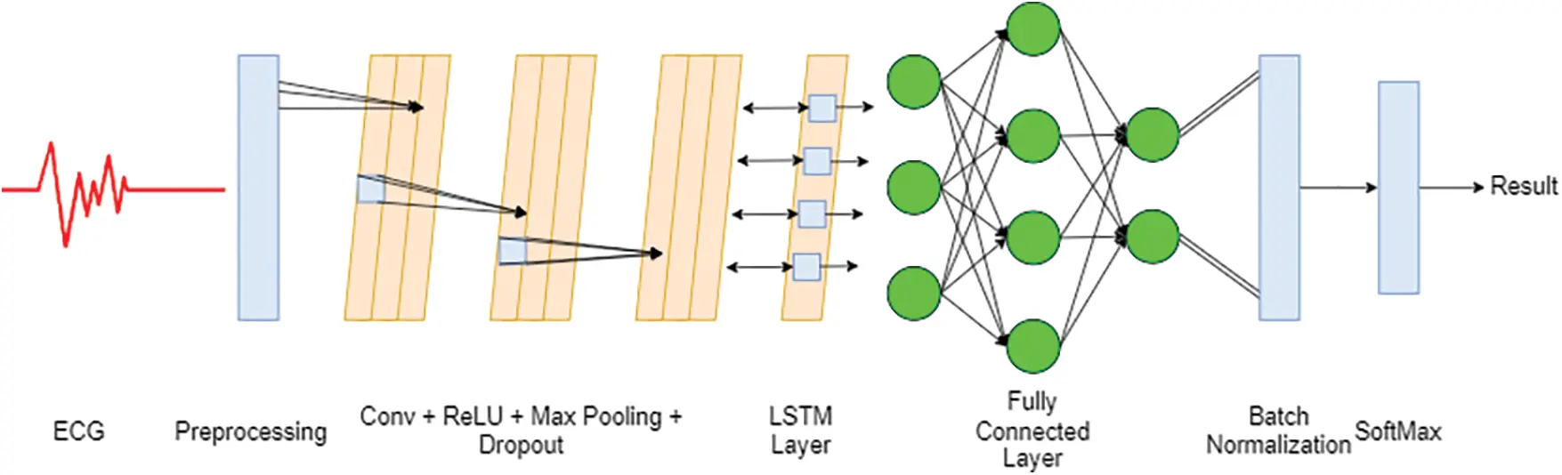 CMC | Free Full-Text | Convolutional LSTM Network for Heart Disease Diagnosis on Electrocardiograms