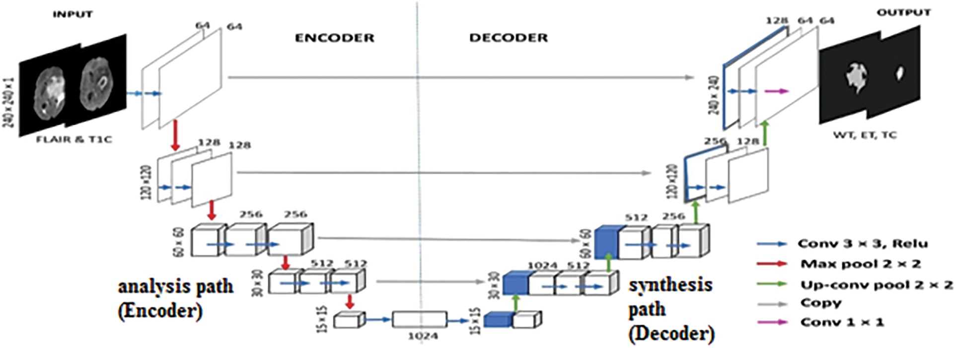 CMC | Free Full-Text | EMU-Net: Automatic Brain Tumor Segmentation and Classification Using ...