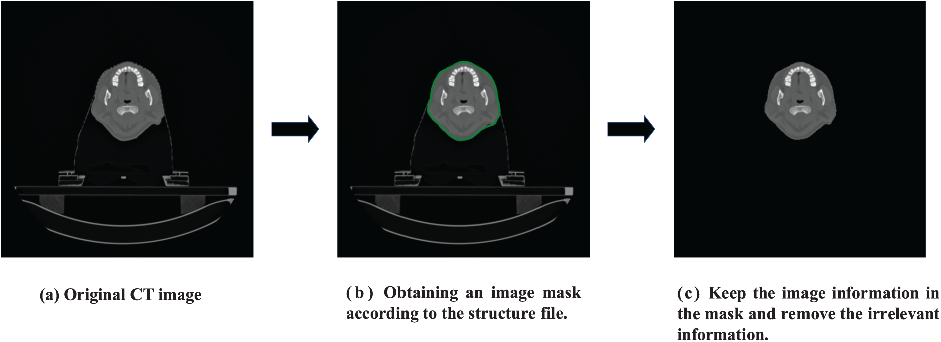 CMC | Free Full-Text | A Novel Unsupervised MRI Synthetic CT Image ...