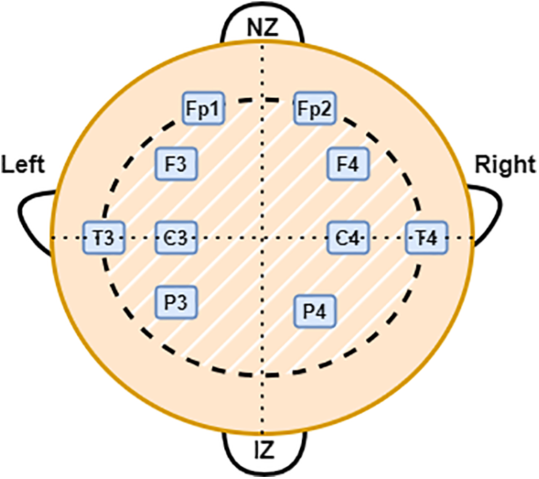 CMC | Free Full-Text | Electroencephalography (EEG) Based Neonatal ...