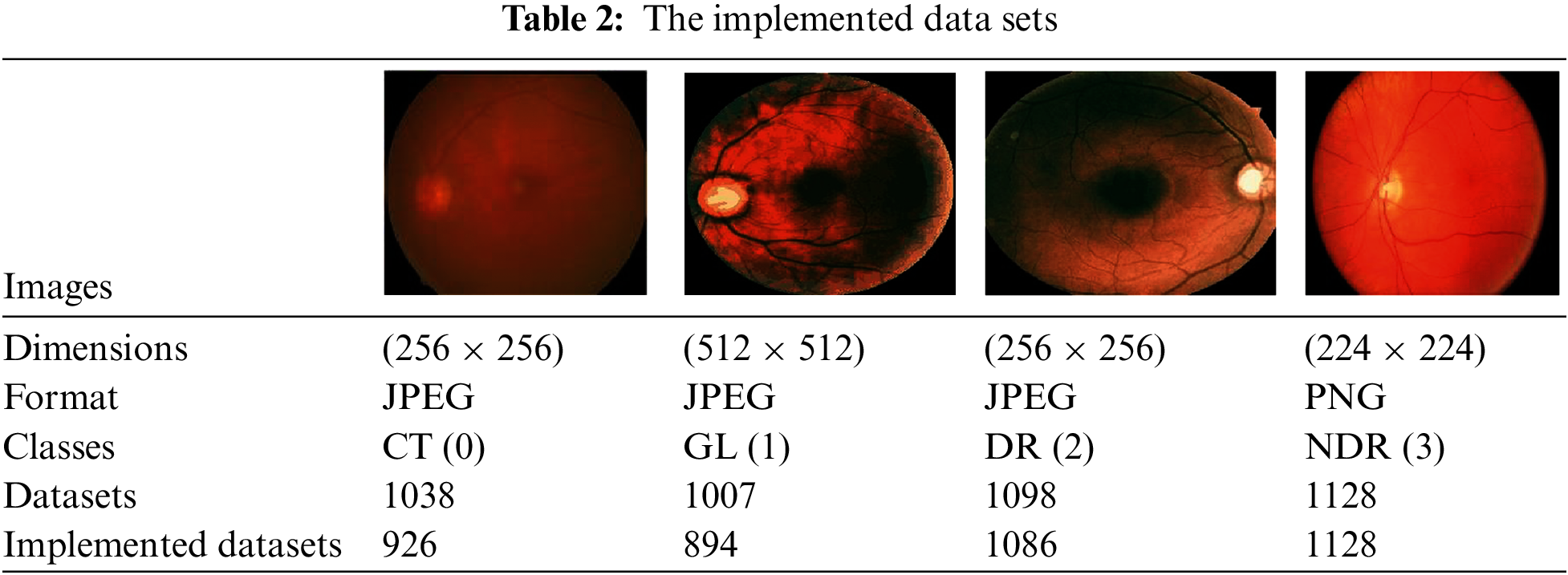 CMC | Free Full-Text | Optimized Deep Learning Approach for Efficient Diabetic Retinopathy ...
