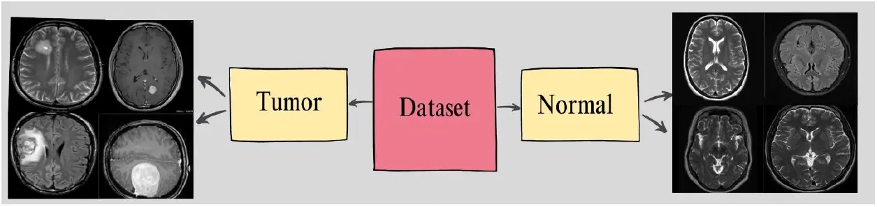 CMC | Free Full-Text | Deep Learning-Enhanced Brain Tumor Prediction ...
