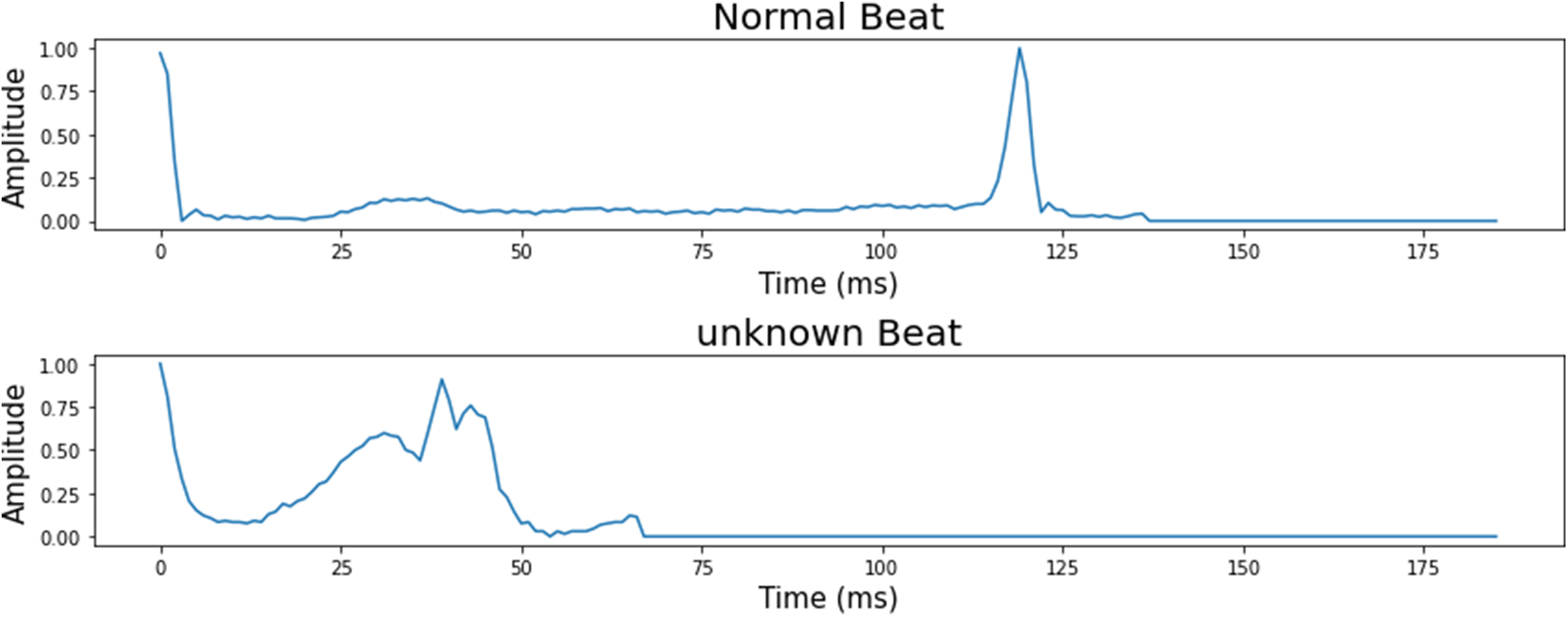 CMC | Free Full-Text | Classification of Electrocardiogram Signals for ...