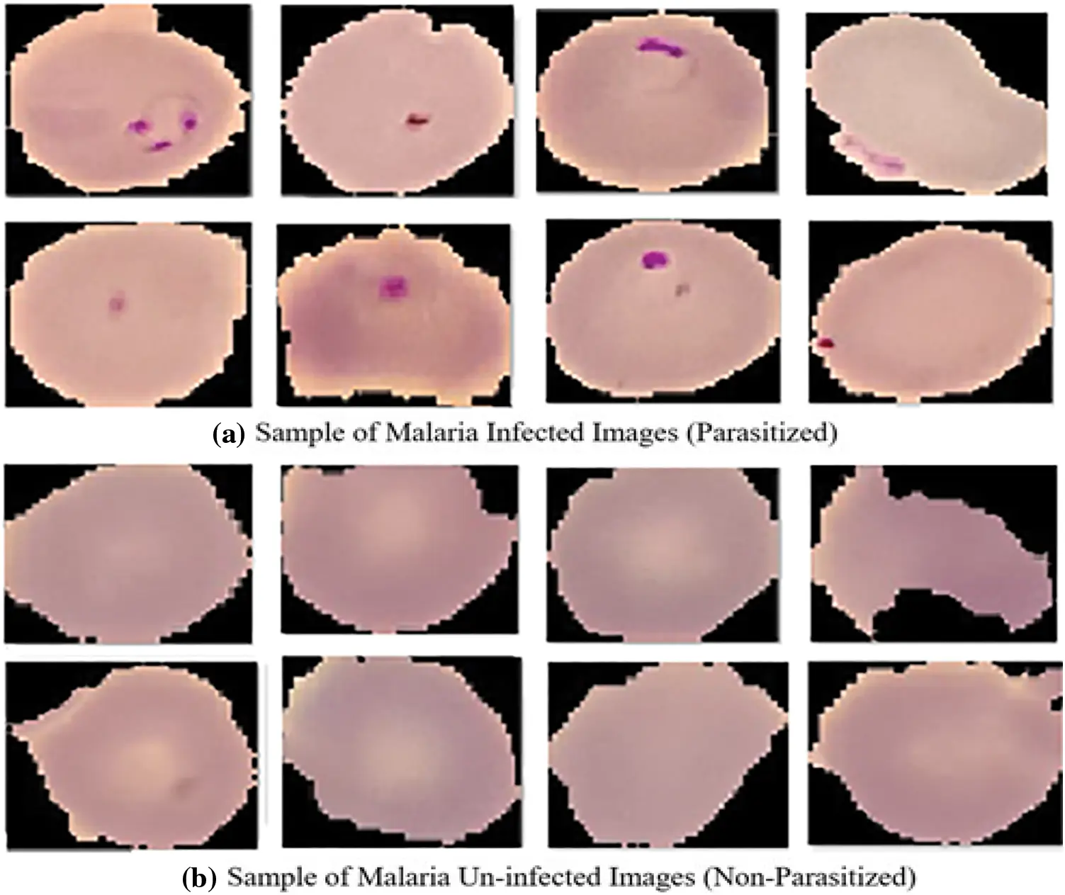 CMC | Free Full-Text | Modeling a Novel Hyper-Parameter Tuned Deep ...