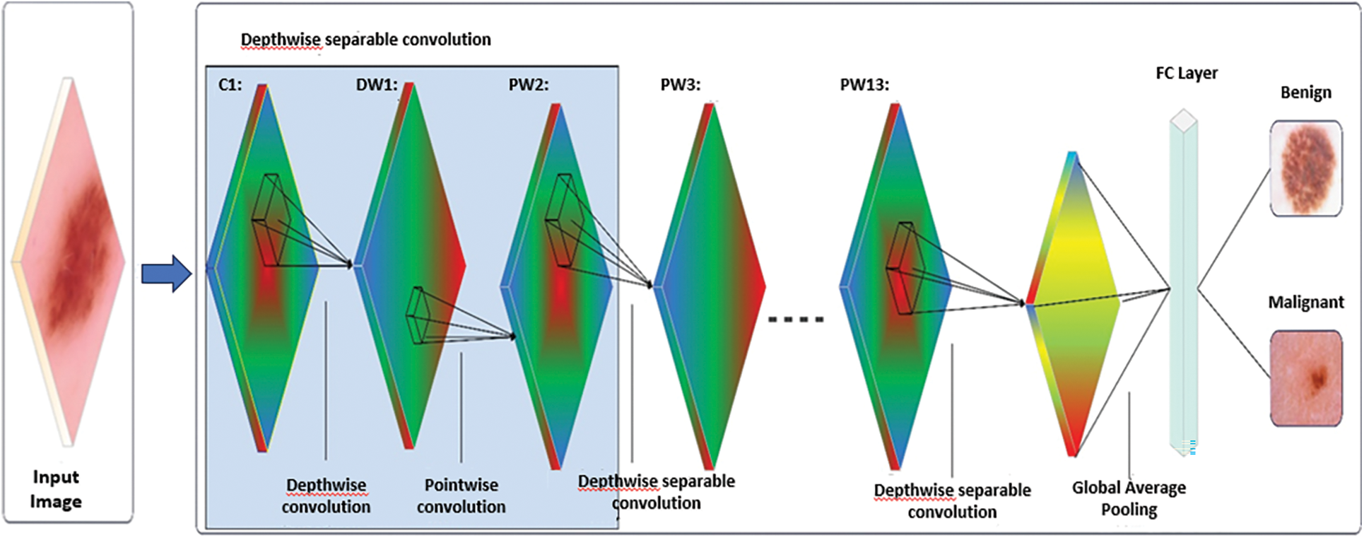 CMC | Free Full-Text | Smart MobiNet: A Deep Learning Approach for ...