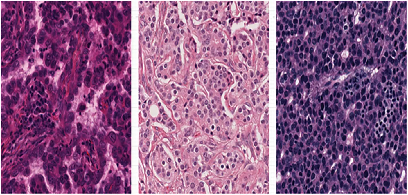 CMC | Free Full-Text | Nuclei Segmentation in Histopathology Images Using Structure-Preserving ...