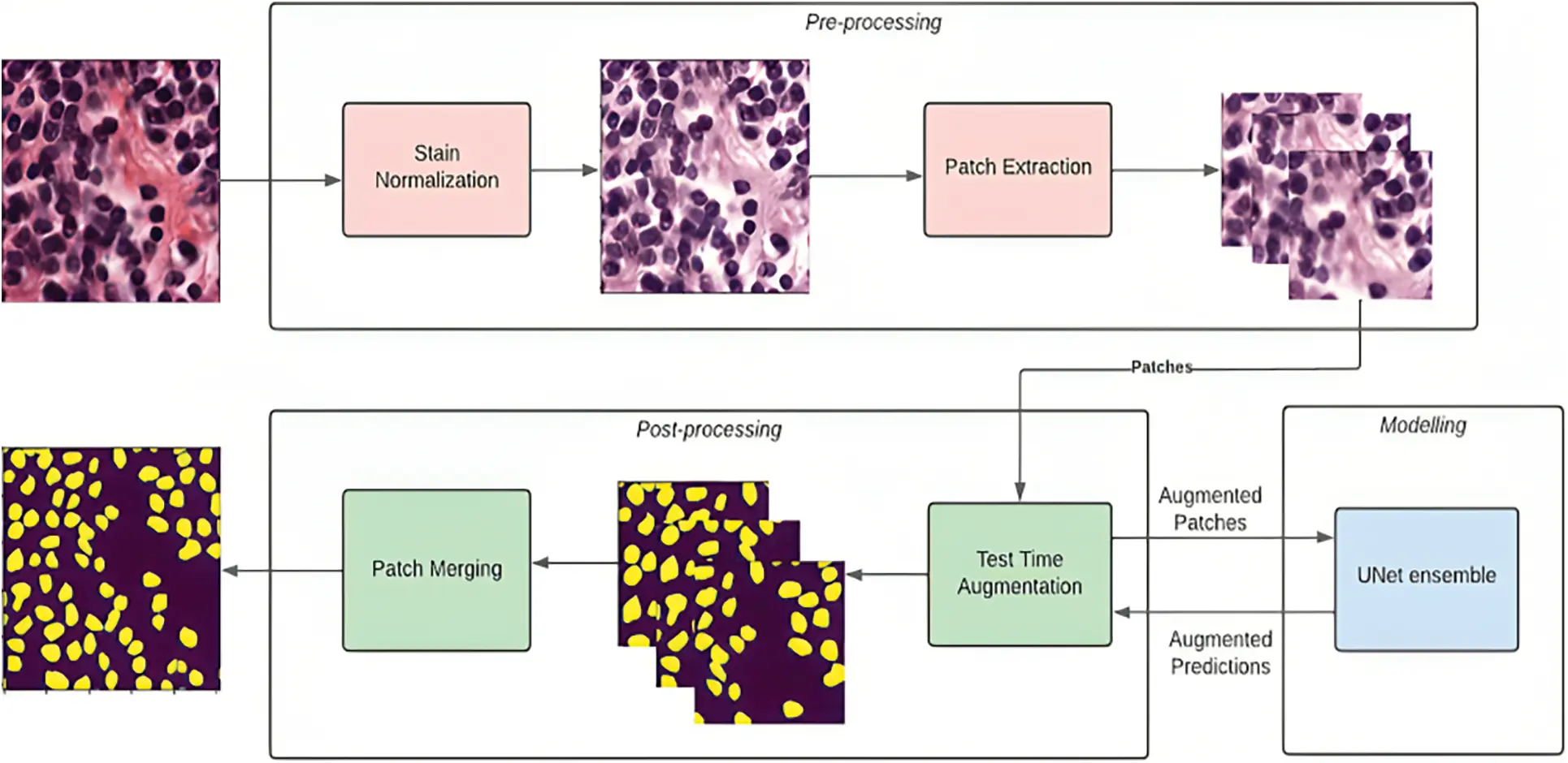CMC | Free Full-Text | Nuclei Segmentation in Histopathology Images Using Structure-Preserving ...