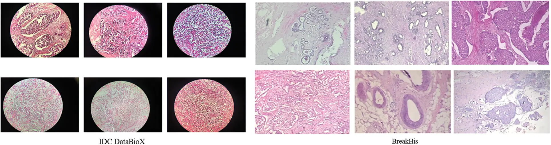 CMC | Free Full-Text | Enhancing Breast Cancer Diagnosis with Channel ...