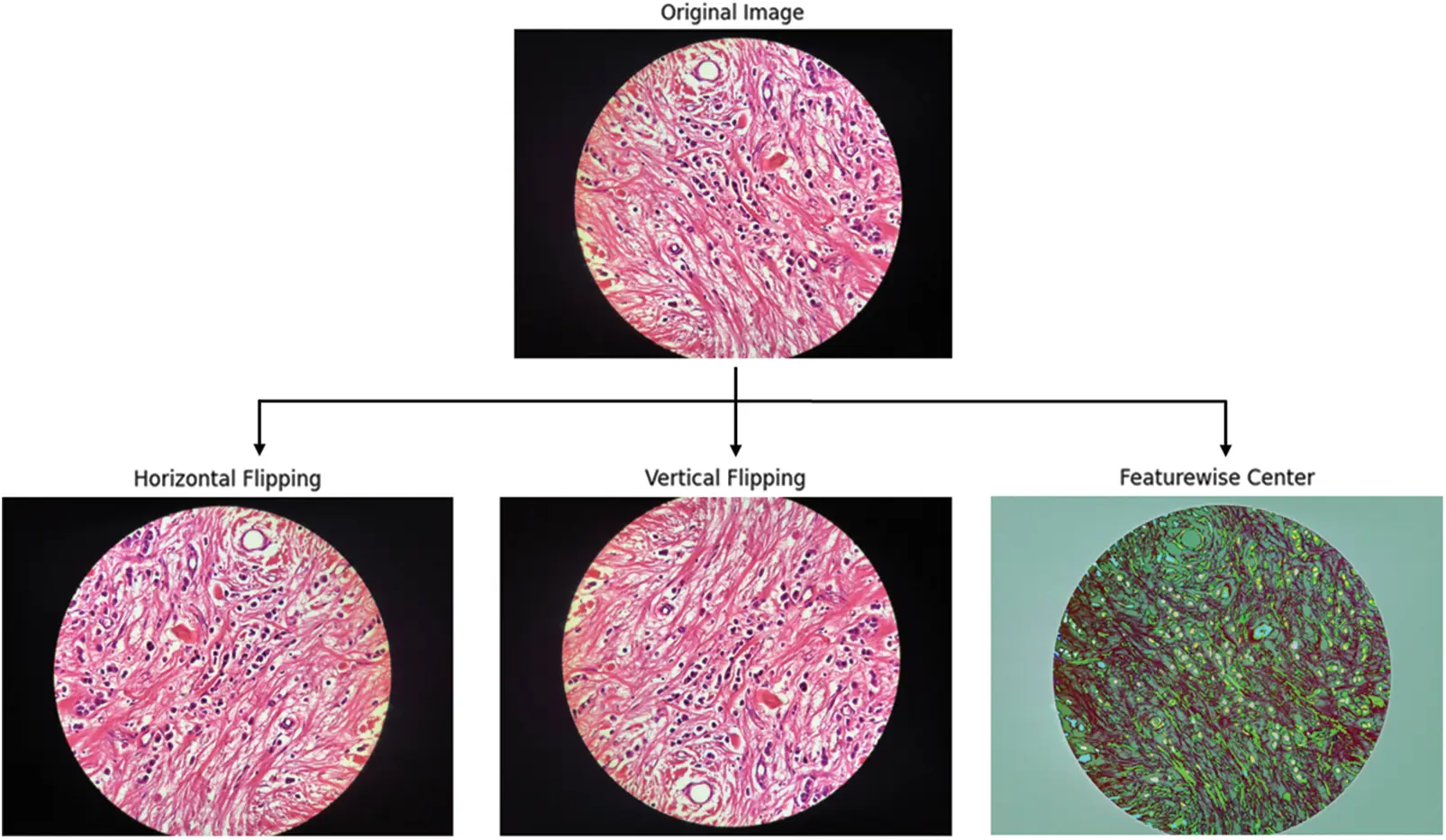 CMC | Free Full-Text | Enhancing Breast Cancer Diagnosis with Channel ...