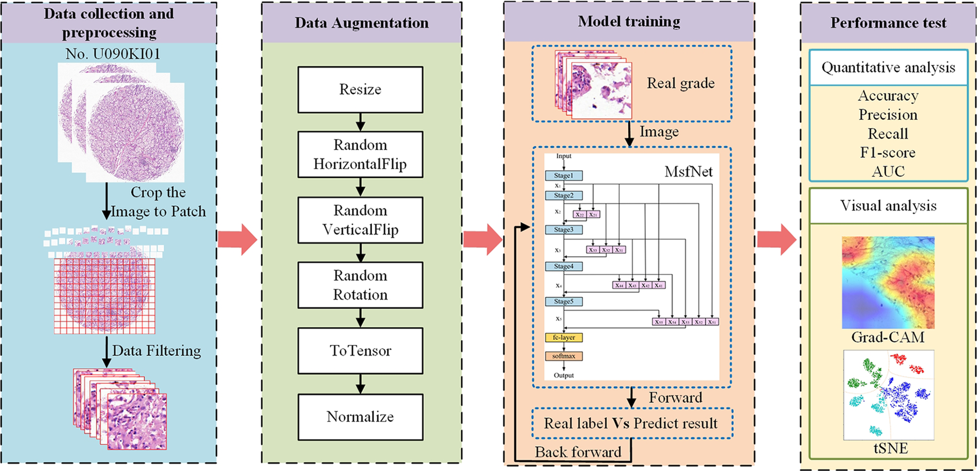 CMC | Free Full-Text | Using MsfNet to Predict the ISUP Grade of Renal ... CMC | Free Full-Text | Using MsfNet to Predict the ISUP Grade of Renal ...