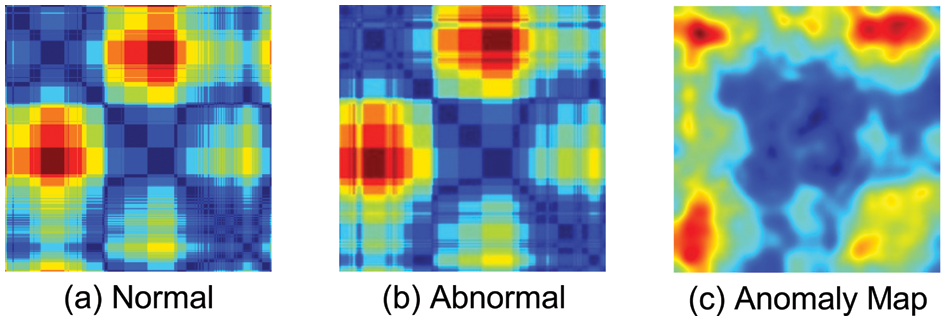 Cmc Free Full Text Defect Detection Model Using Time Series Data Augmentation And Transformation
