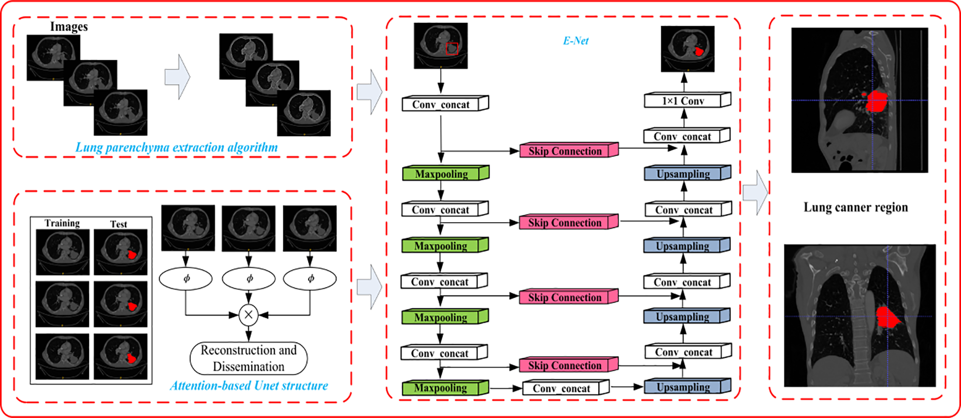 CMC | Free Full-Text | Multilevel Attention Unet Segmentation Algorithm for Lung Cancer Based on ...