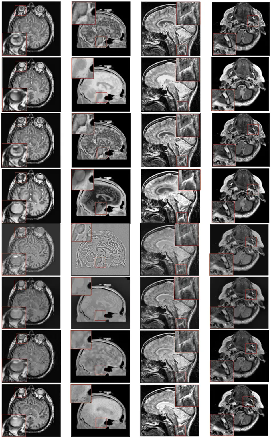 CMC | Free Full-Text | Multimodality Medical Image Fusion Based on ...