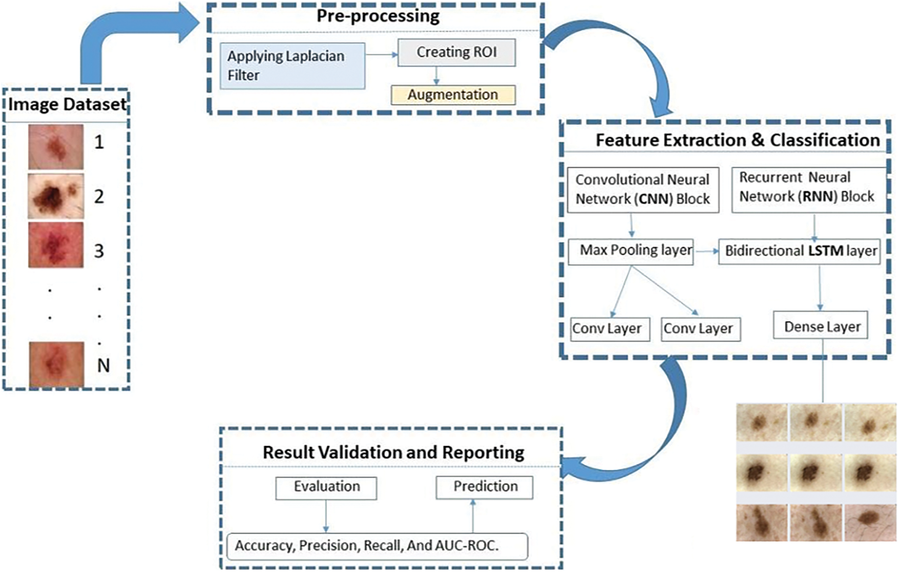 CMC | Free Full-Text | Enhancing Skin Cancer Diagnosis with Deep ...