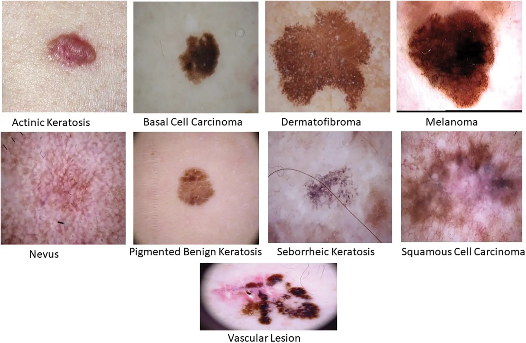 CMC | Free Full-Text | Enhancing Skin Cancer Diagnosis with Deep ...