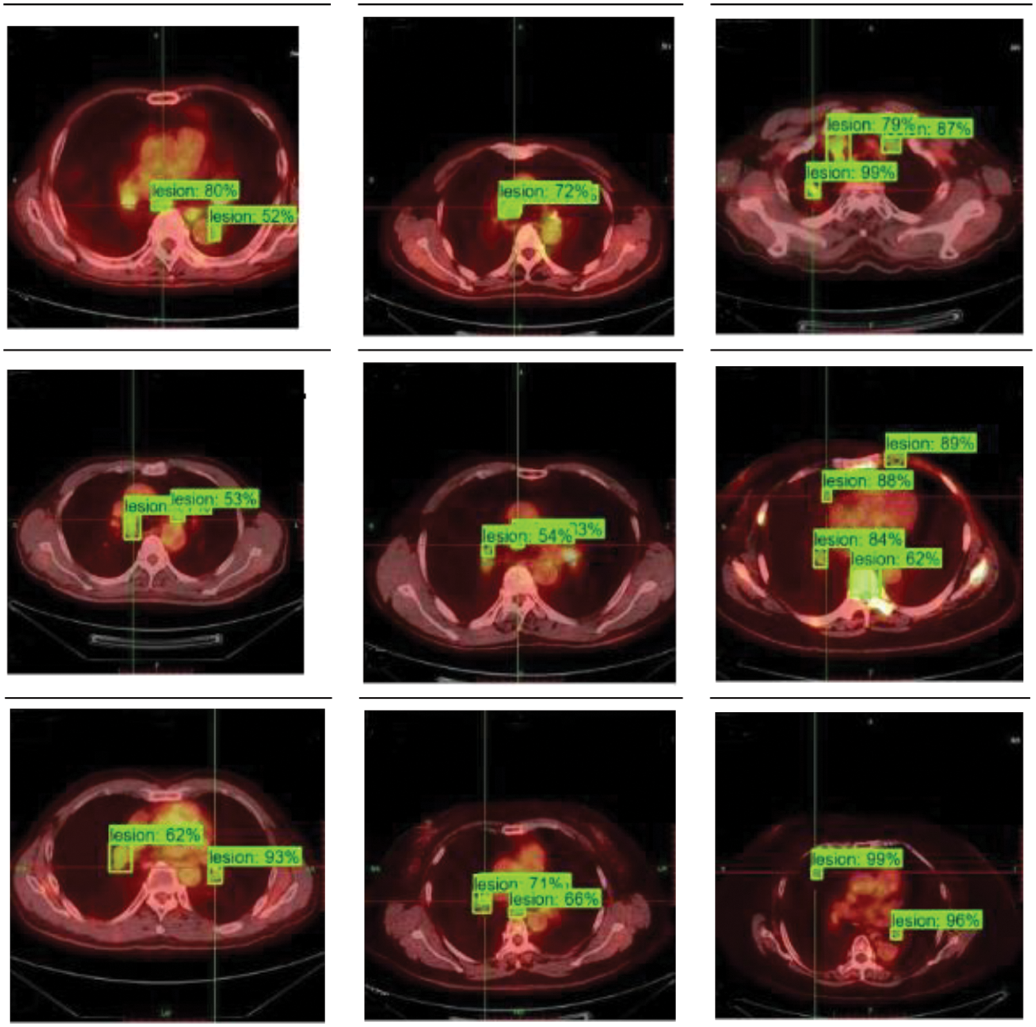 CMC | Free Full-Text | MCIF-Transformer Mask RCNN: Multi-Branch Cross-Scale Interactive Feature ...