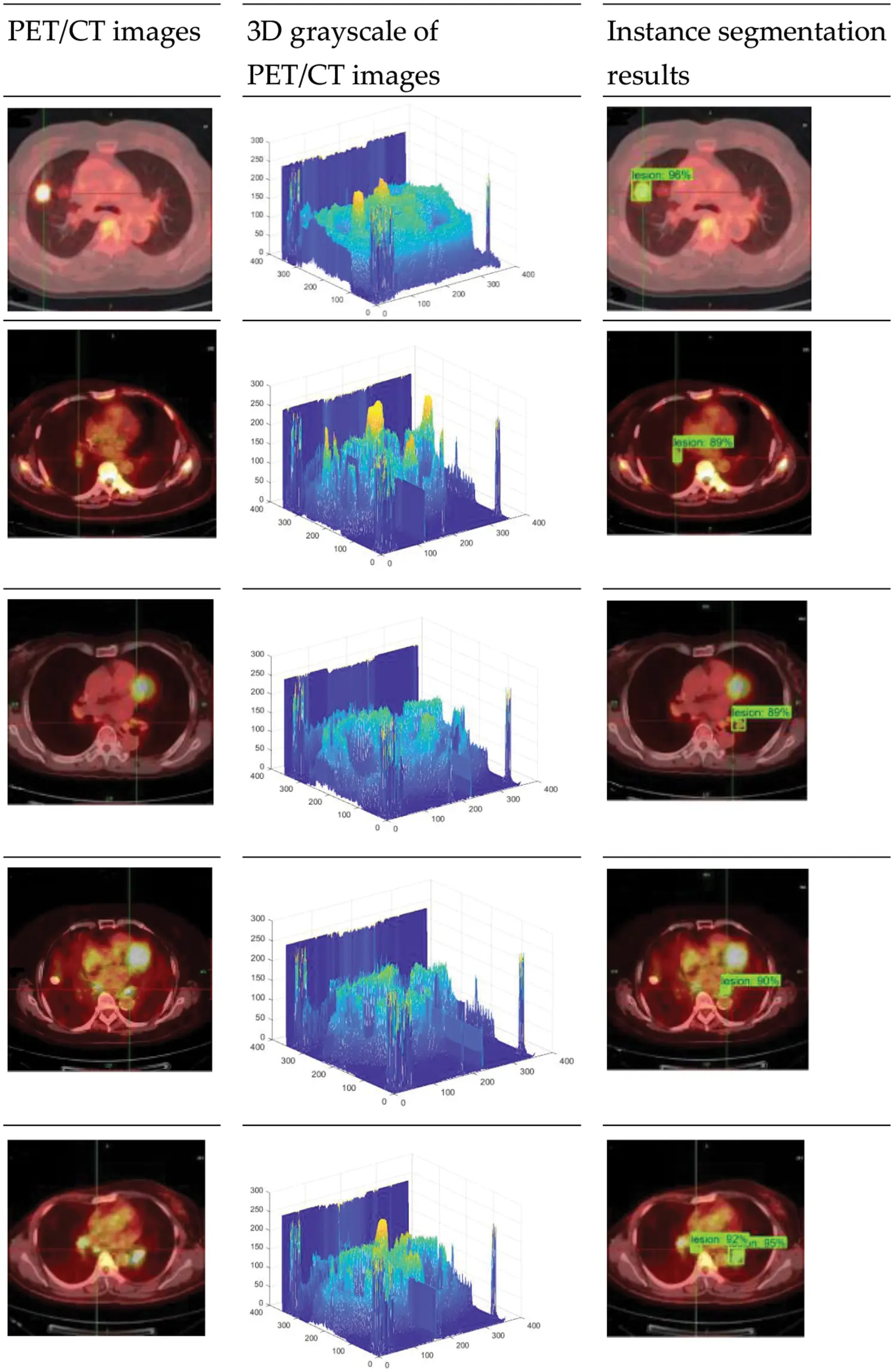CMC | Free Full-Text | MCIF-Transformer Mask RCNN: Multi-Branch Cross-Scale Interactive Feature ...