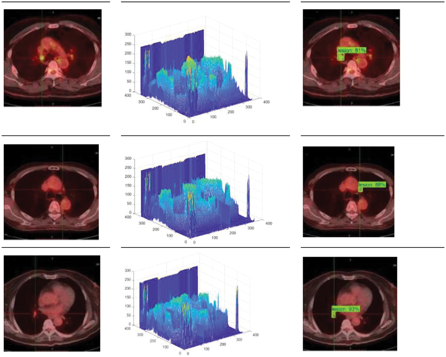 CMC | Free Full-Text | MCIF-Transformer Mask RCNN: Multi-Branch Cross-Scale Interactive Feature ...