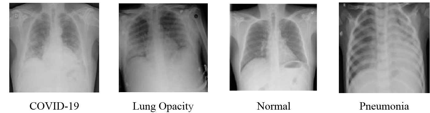 CMC | Free Full-Text | MSD-Net: Pneumonia Classification Model Based on ...