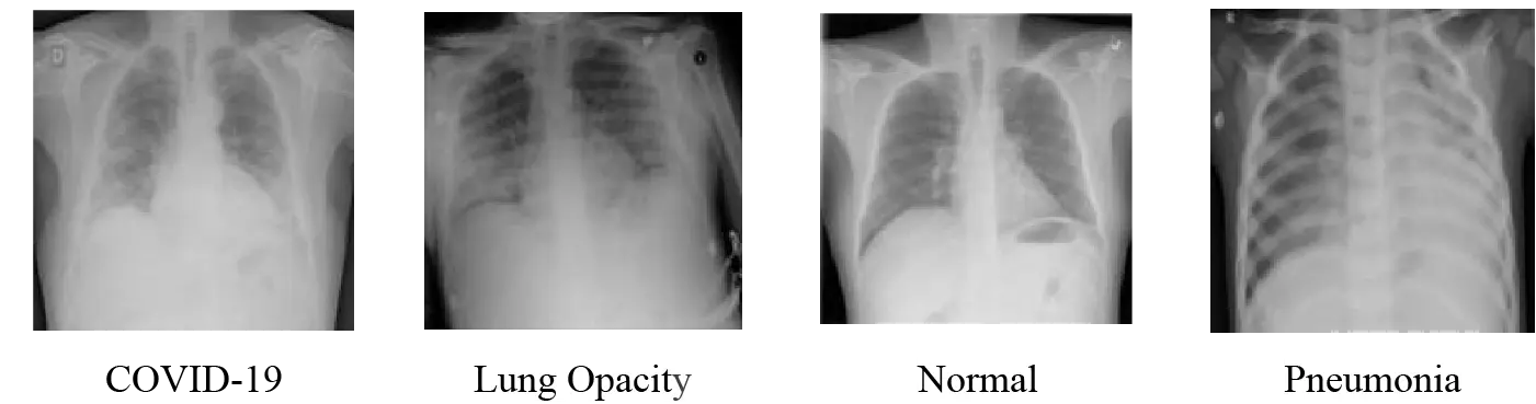 CMC | Free Full-Text | MSD-Net: Pneumonia Classification Model Based on ...