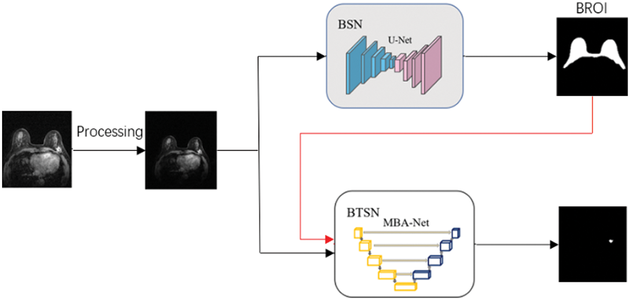 Cmc Free Full Text Two Stages Segmentation Algorithm Of Breast Tumor In Dce Mri Based On