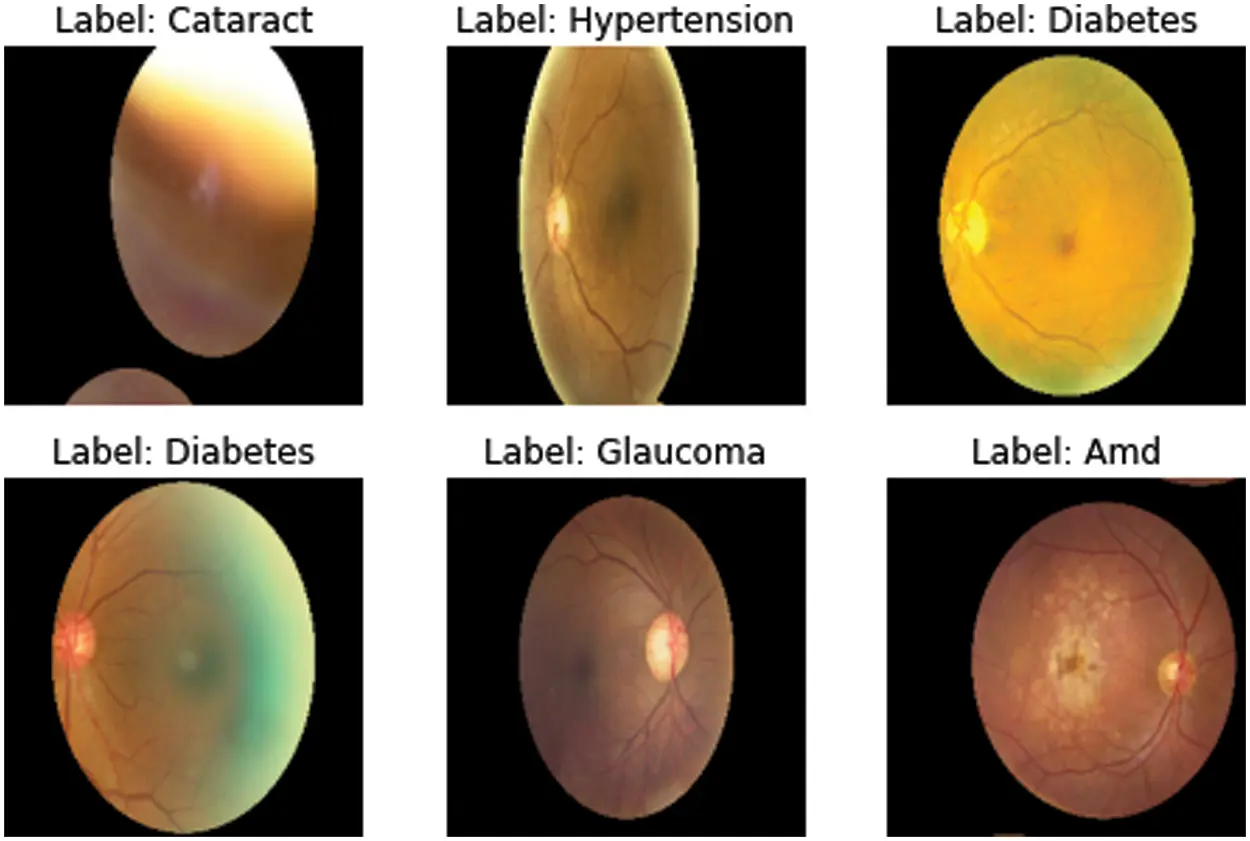 CMC | Free Full-Text | Deep Transfer Learning Models for Mobile-Based ...
