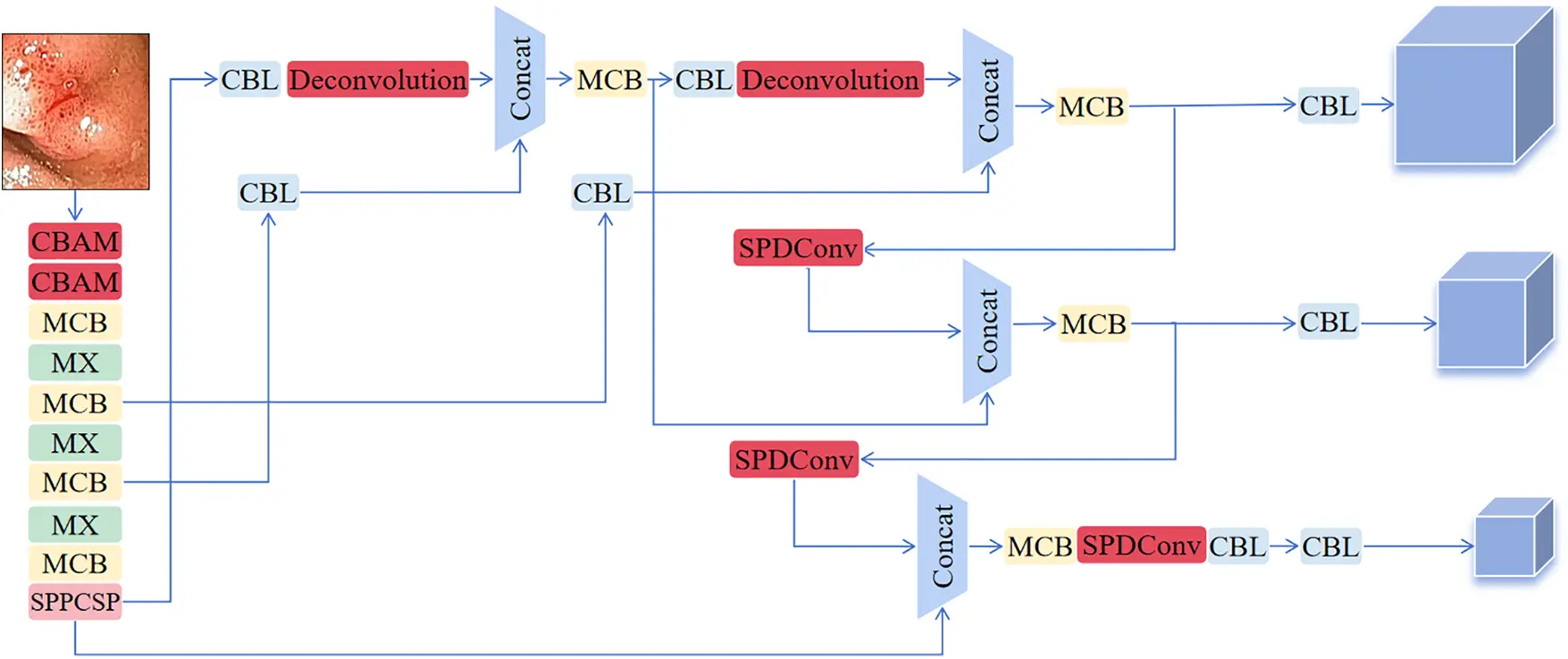 CMC | Free Full-Text | PD-YOLO: Colon Polyp Detection Model Based on ...