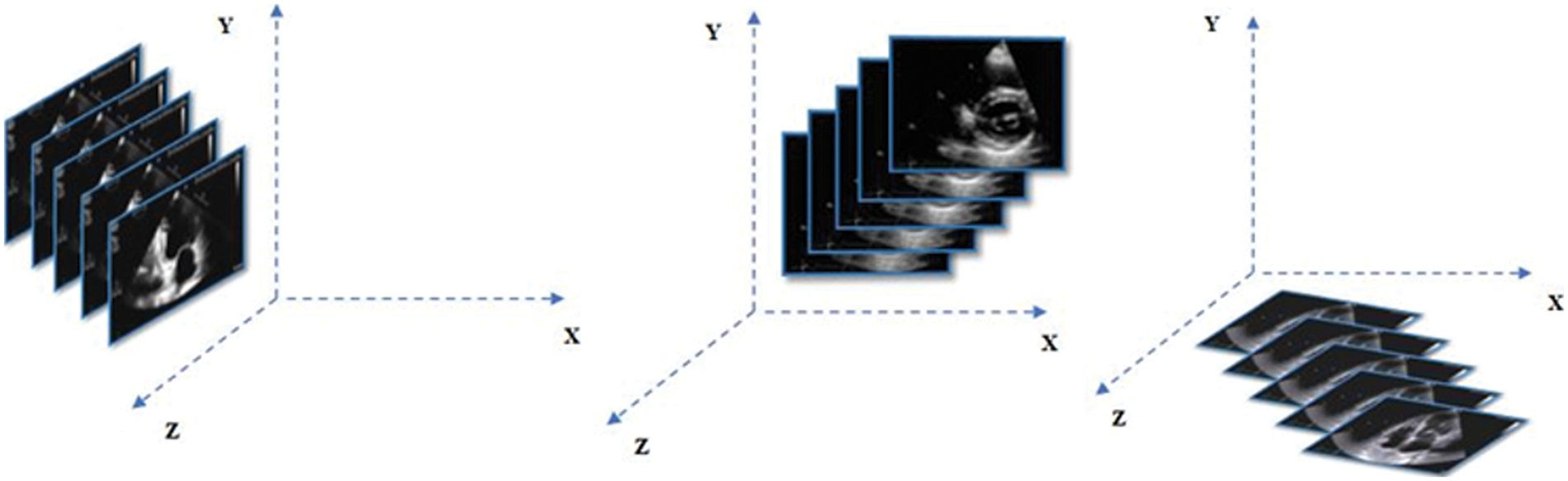 CSSE | Free Full-Text | 3D Echocardiogram Reconstruction Employing a ...