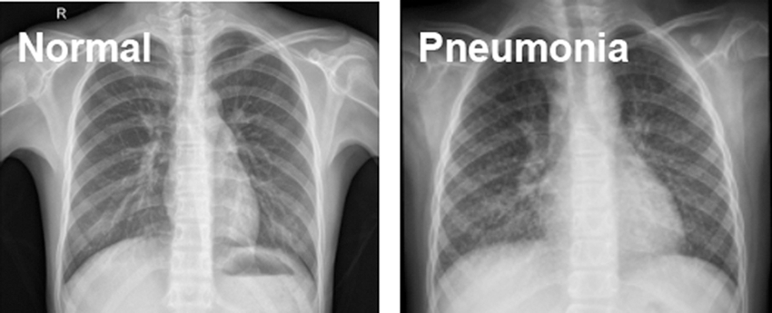 CSSE | Free Full-Text | MDEV Model: A Novel Ensemble-Based Transfer ...