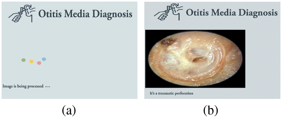 CSSE | Free Full-Text | Diagnosis of Middle Ear Diseases Based on ...