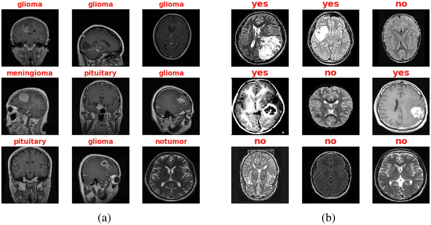 CSSE | Free Full-Text | An Improved Deep Structure for Accurately Brain ...