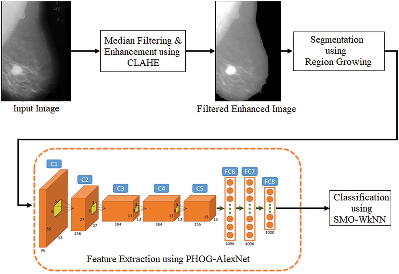 CSSE | Free Full-Text | Classification of Multi-view Digital Mammogram Images Using SMO-WkNN