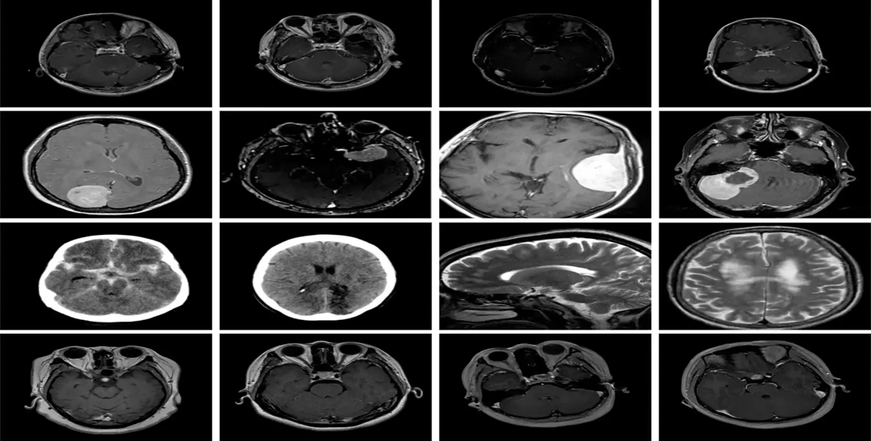 CSSE | Free Full-Text | Computer-Aided Diagnosis Model Using Machine ...