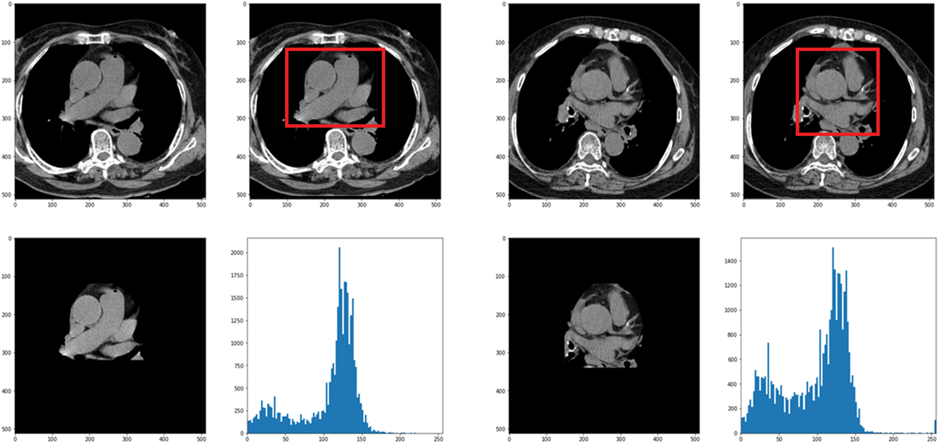 CSSE | Free Full-Text | Cardiac CT Image Segmentation for Deep Learning–Based Coronary Calcium ...