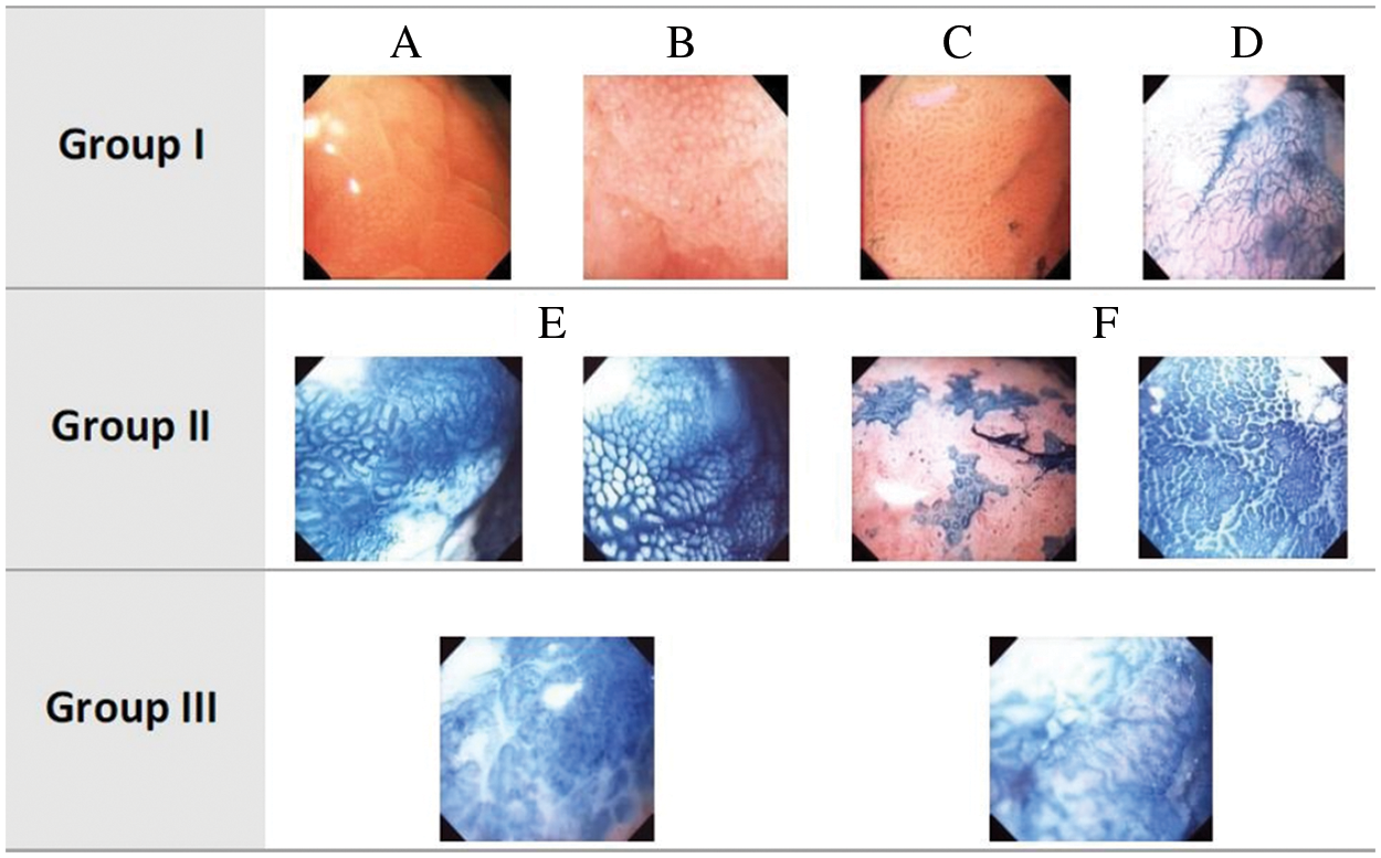Csse Free Full Text Classification Of Gastric Lesions Using Gabor