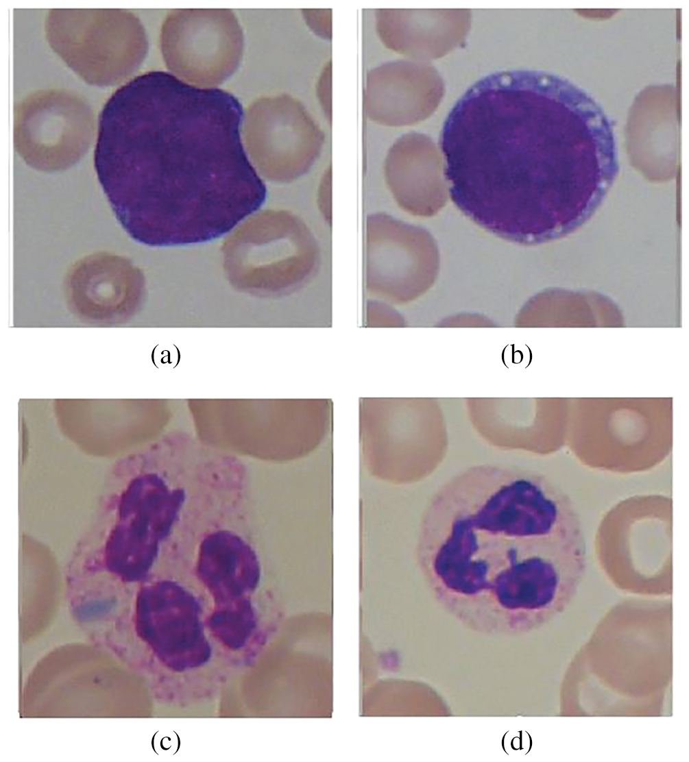 CSSE | Free Full-Text | Automated Leukemia Screening and Sub-types Classification Using Deep ...