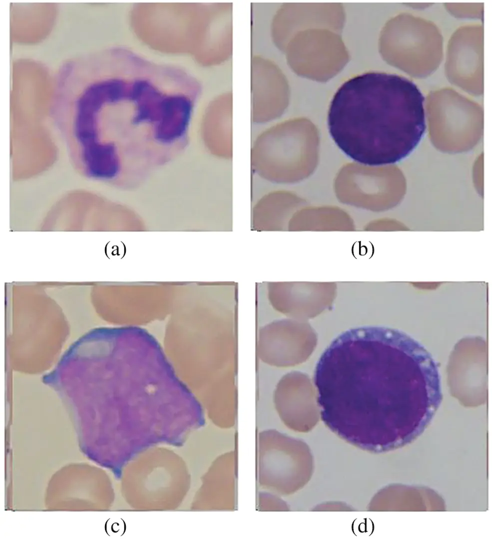 CSSE | Free Full-Text | Automated Leukemia Screening and Sub-types Classification Using Deep ...