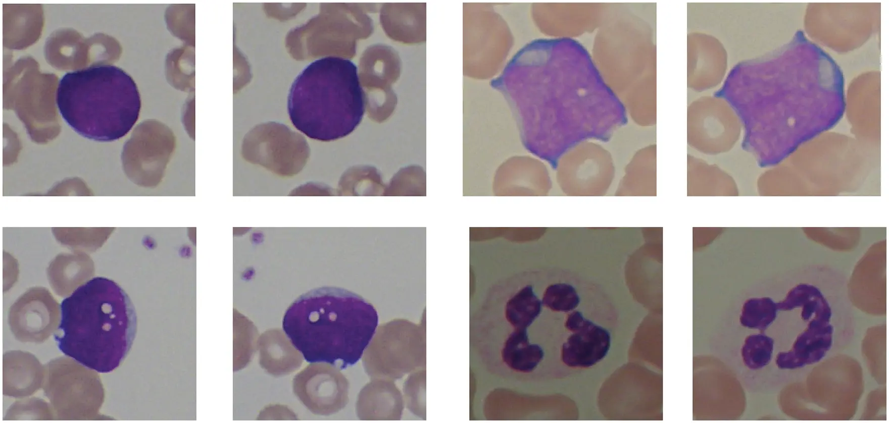 CSSE | Free Full-Text | Automated Leukemia Screening and Sub-types Classification Using Deep ...