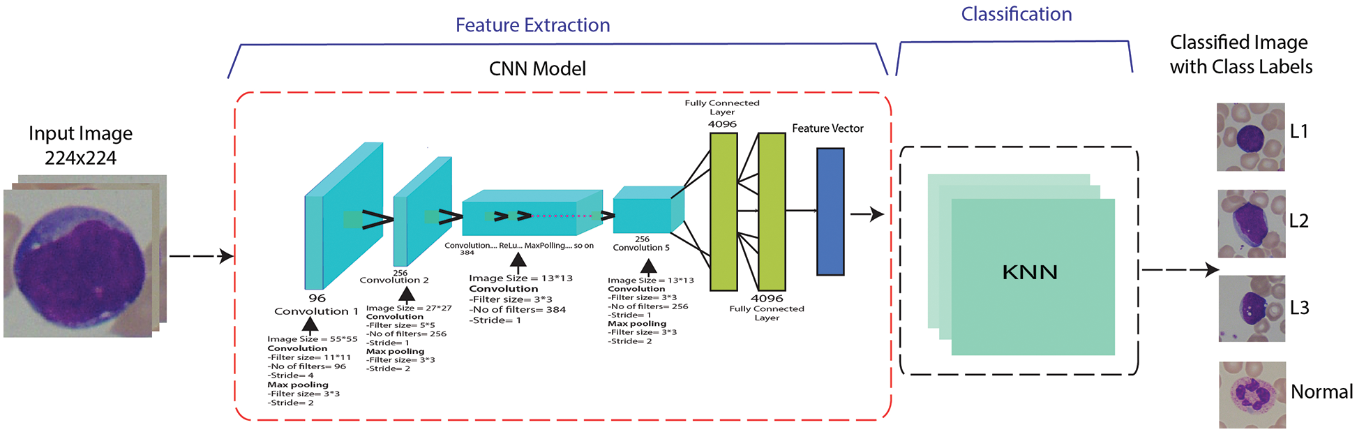 CSSE | Free Full-Text | Automated Leukemia Screening and Sub-types Classification Using Deep ...