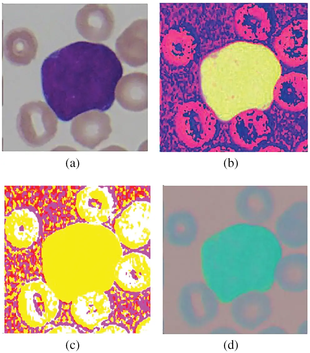 CSSE | Free Full-Text | Automated Leukemia Screening and Sub-types Classification Using Deep ...